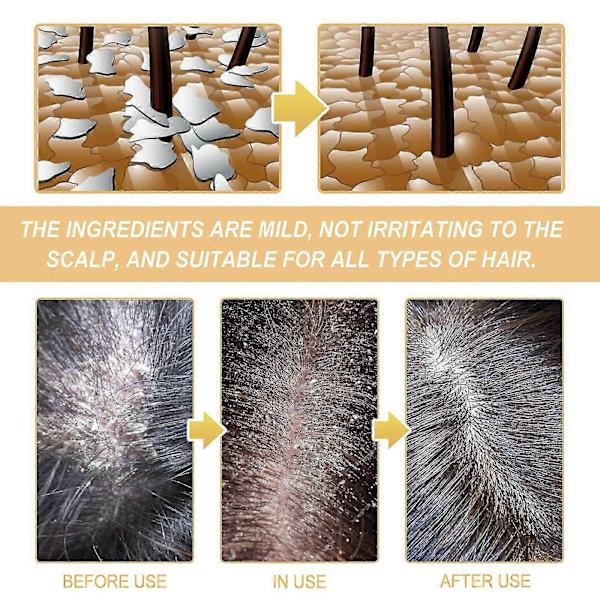 EELHOE Risschampo Skonsamma ingredienser rengör, återfuktar, hydrerar ...