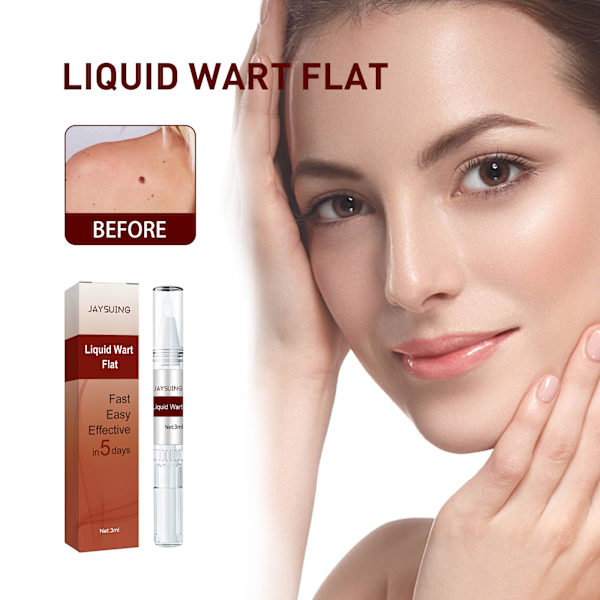 Flytande penna för borttagning av vårtor Mullvadsborttagning för ...