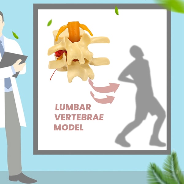 Lumbarvirvelmodell Anatomisk Ryggrad Lumbar Disc Herniation Anatomi ...
